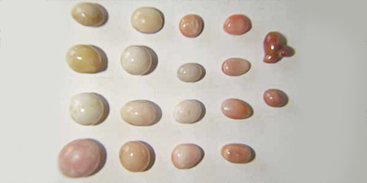 The Alluring Beauty and Rarity of Conch Pearls: An Overview