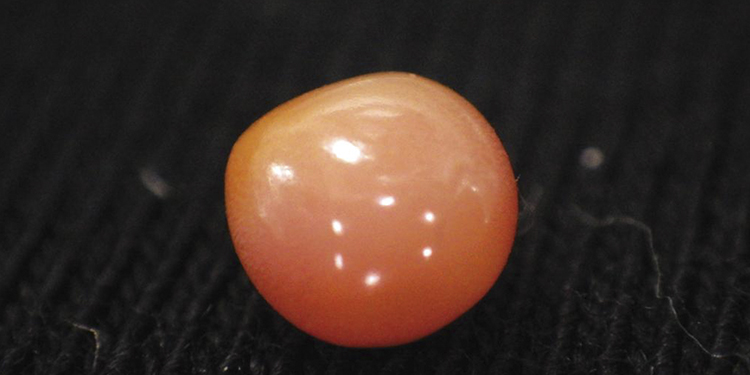 The Alluring Beauty and Rarity of Conch Pearls: An Overview